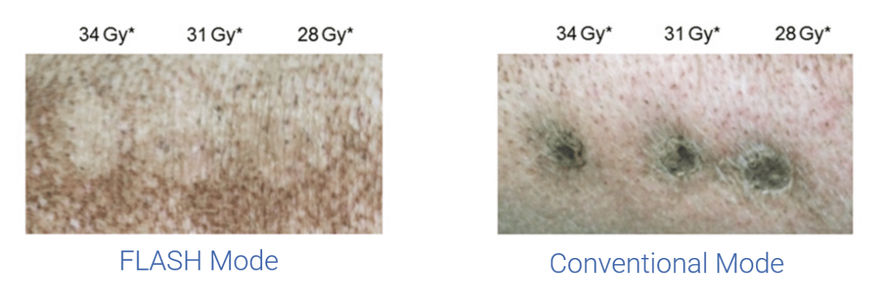 FLASH Radiotherapy | THERYQ